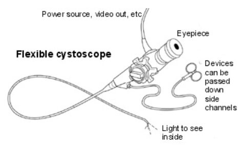 Flexible cystoscopy - Urology Waikato